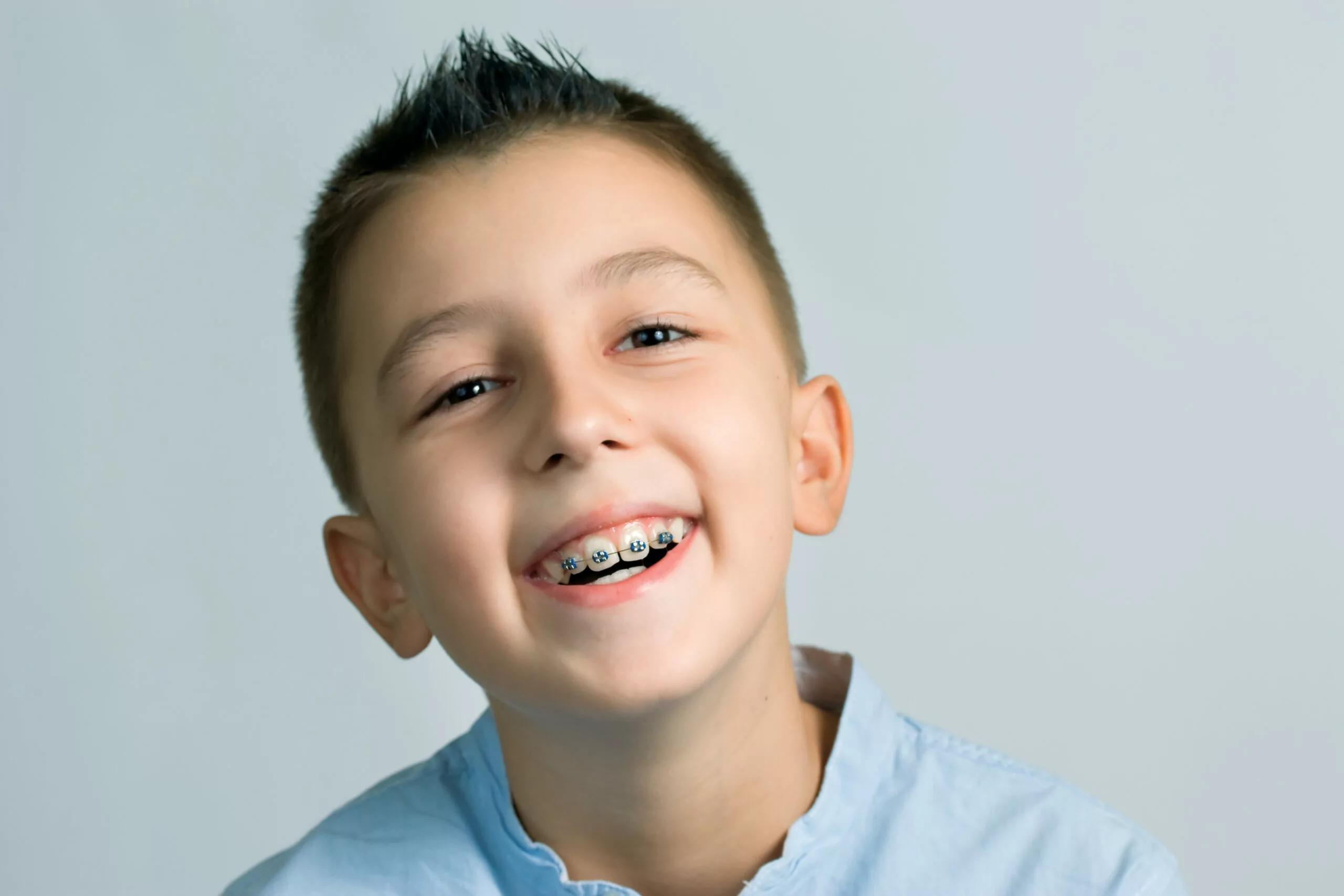 Early Orthodontics: Is It Worth It? - The Windsor Dental Practice